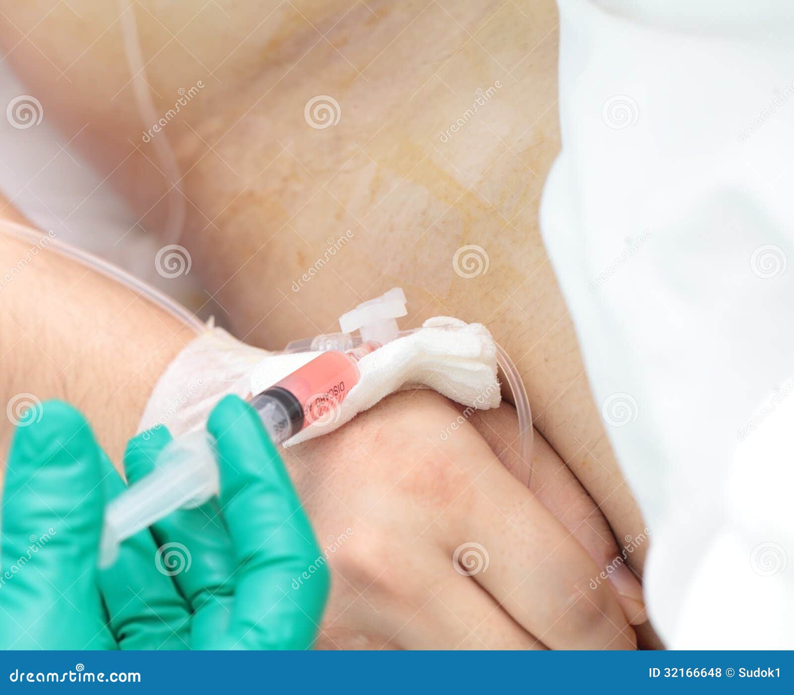 Injection into the Catheter from the Patient. Stock Photo - Image of ...