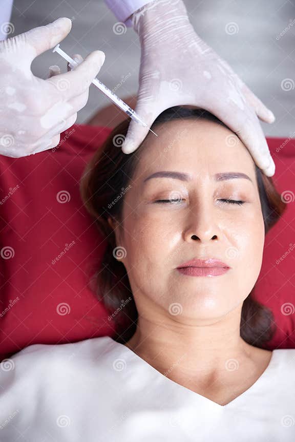 Injection De Botox De Front Image stock - Image du injection, above ...