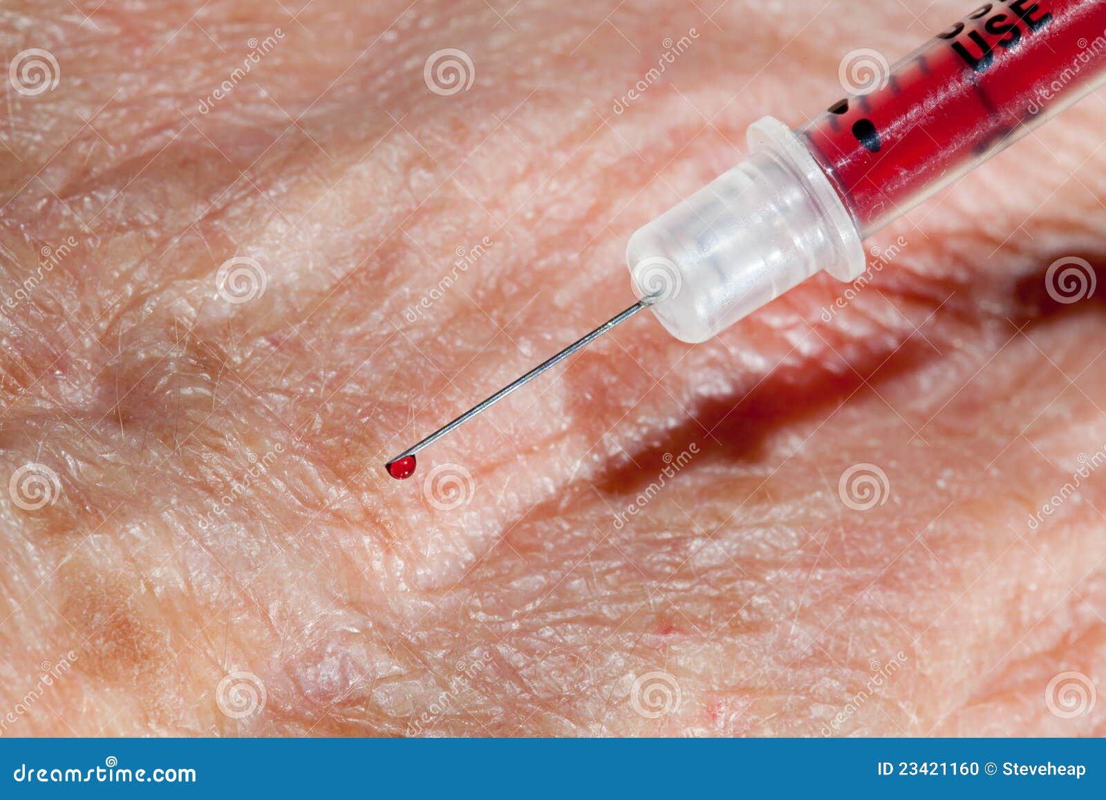 Injection into Hand of Senior Male Stock Photo - Image of front, dose ...