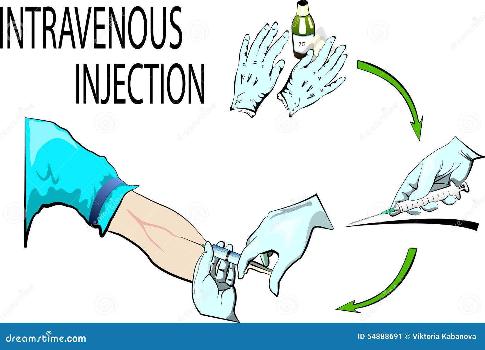 Injection intraveineuse illustration de vecteur. Illustration of ...