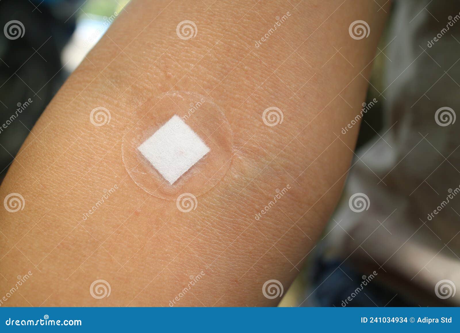 Injection Plaster Cover on the Hand Stock Photo - Image of injection ...