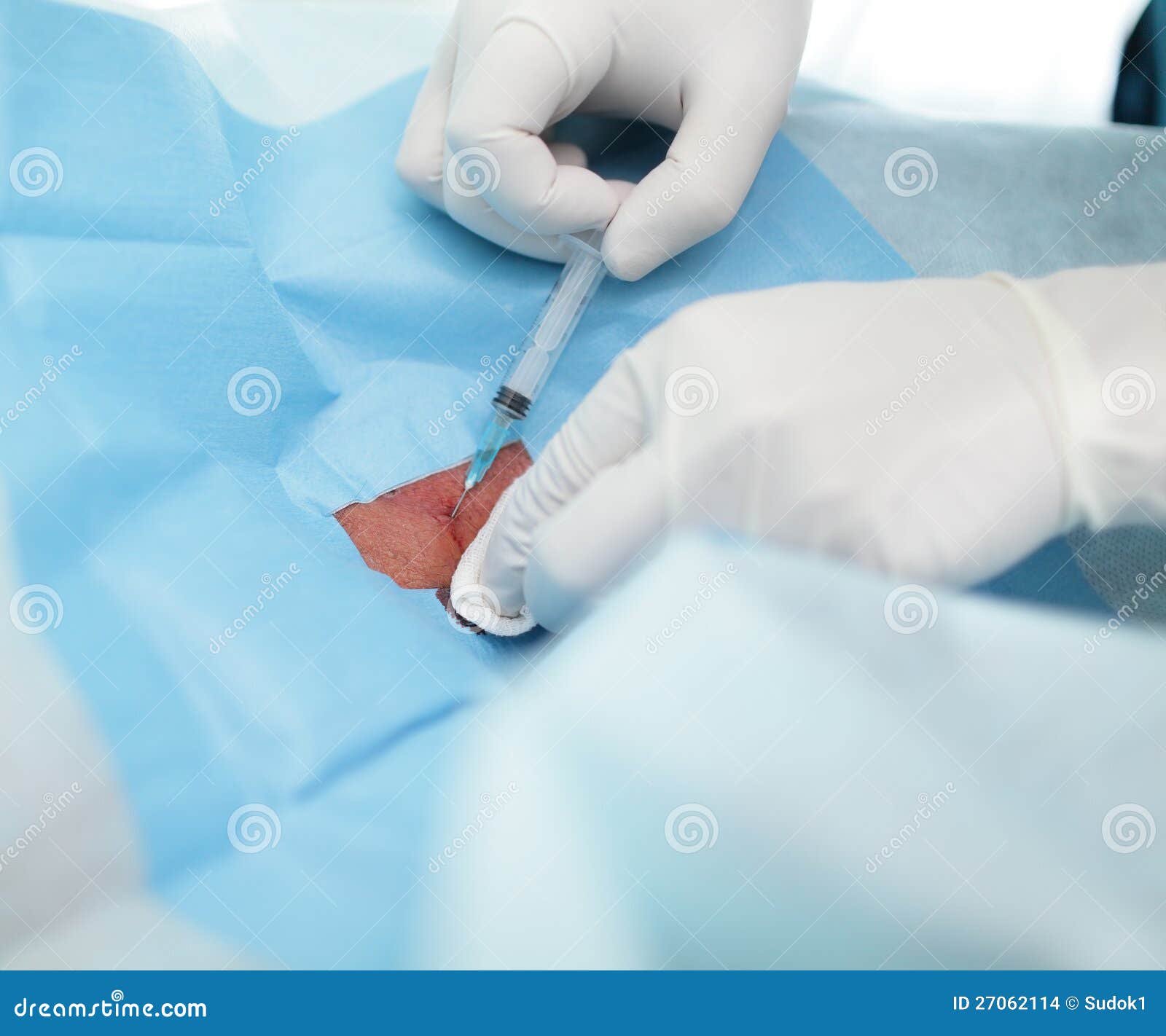 Injection in a Sterile Environment. Stock Photo - Image of illness ...