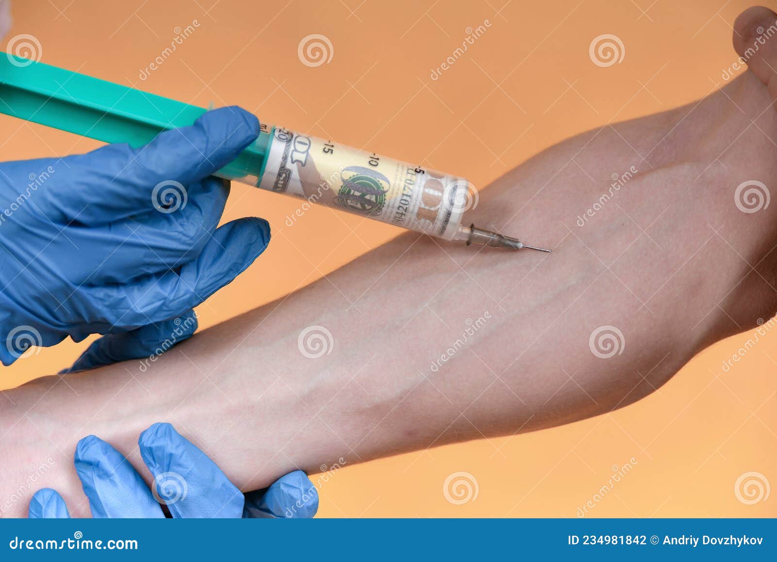 Injection with a Syringe with Dollars into a Vein in the Patient`s Arm ...