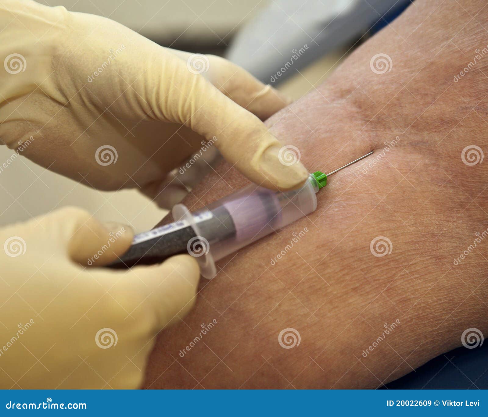 Injection vein arm stock image. Image of syringe, doctor - 20022609