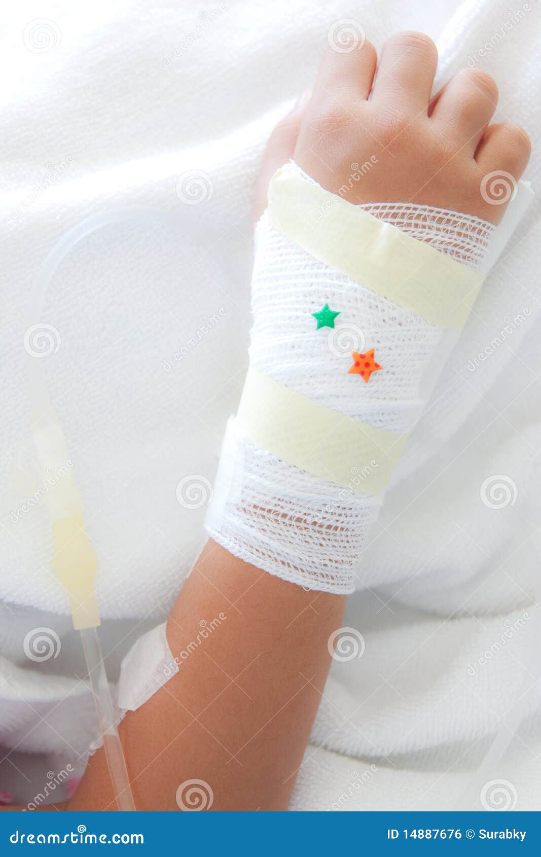 Injured arm stock photo. Image of fever, saline, clinical - 14887676