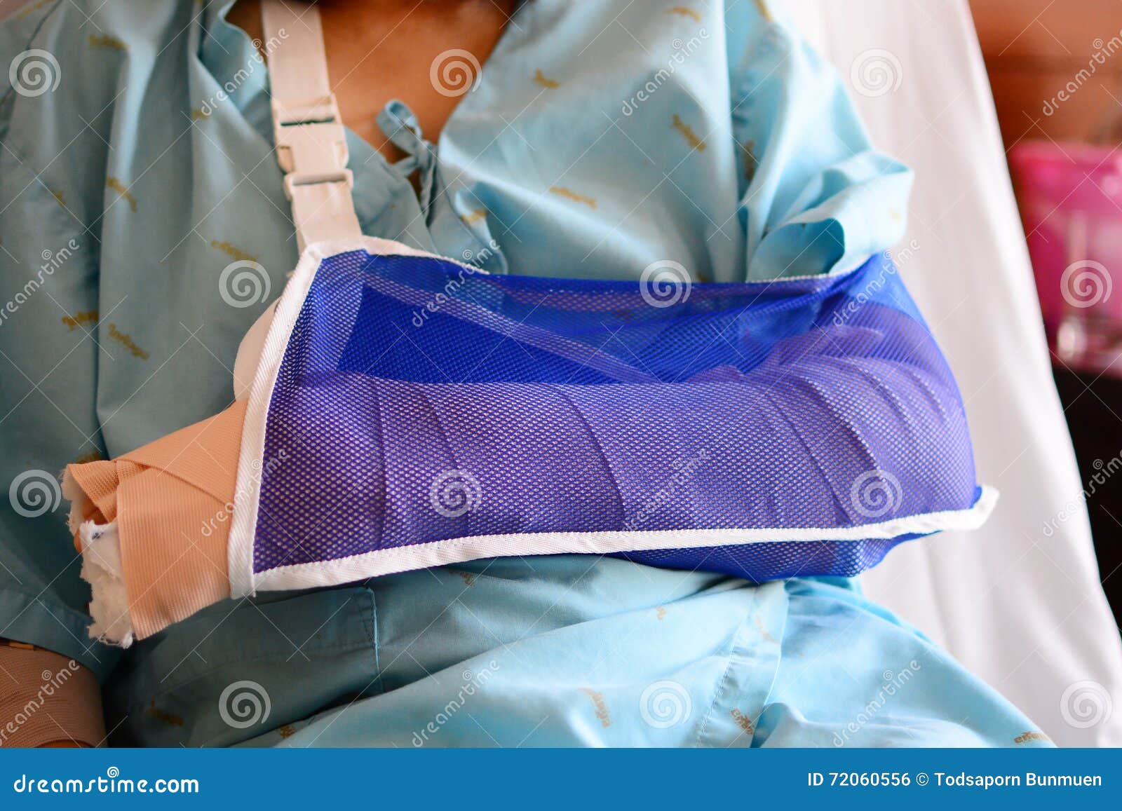 An Injured Arm from Accident with Arm Sling Stock Photo - Image of ...