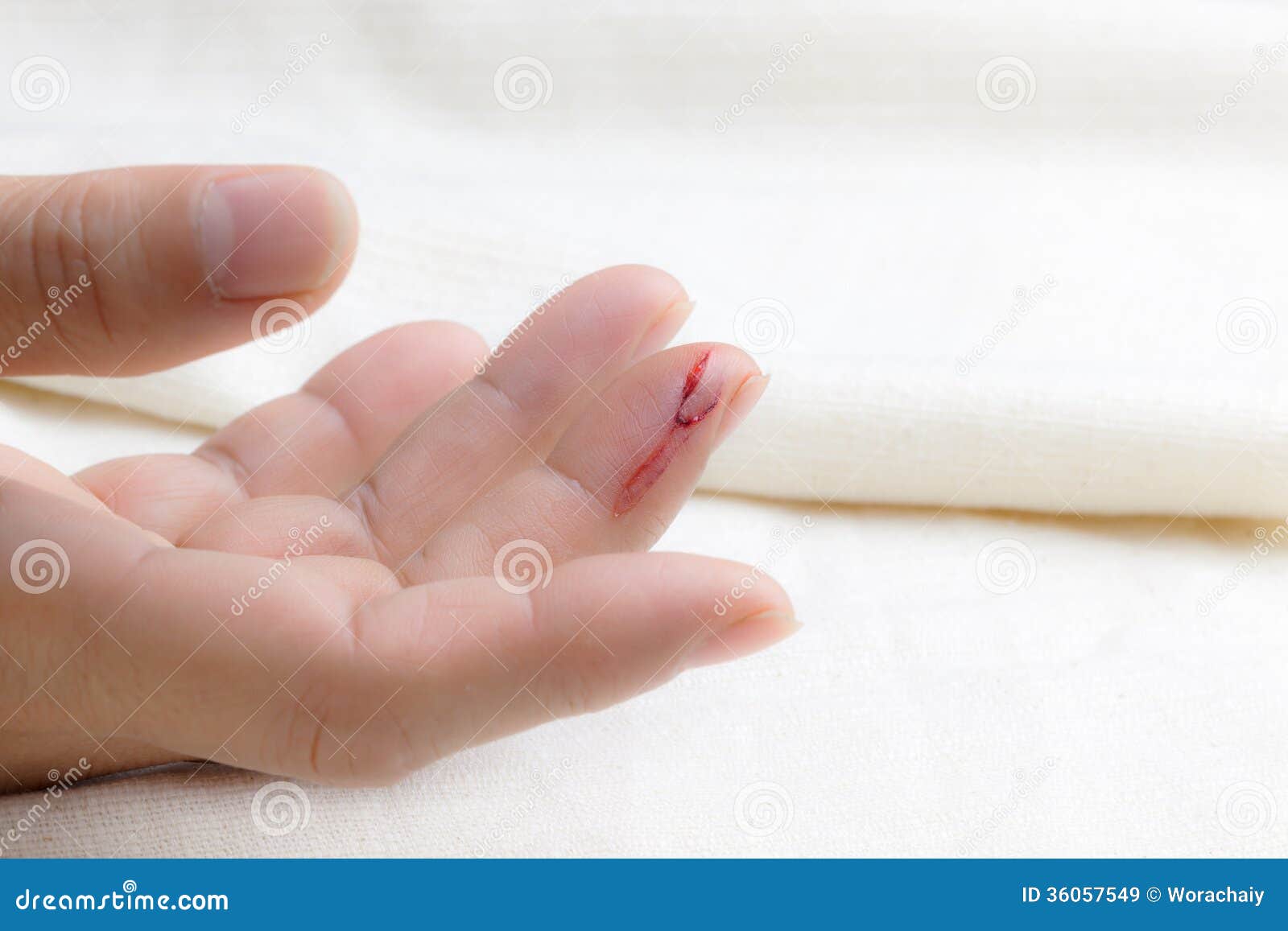 Injured finger stock image. Image of wound, painful, touch - 36057549