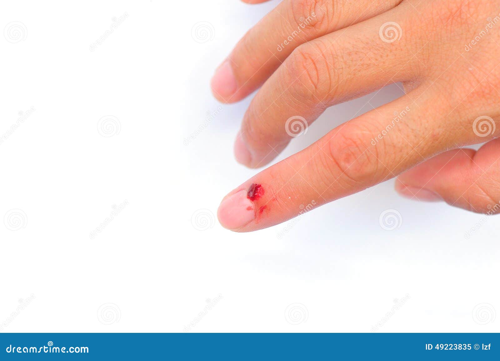 Injured finger stock image. Image of injured, bleed, finger - 49223835