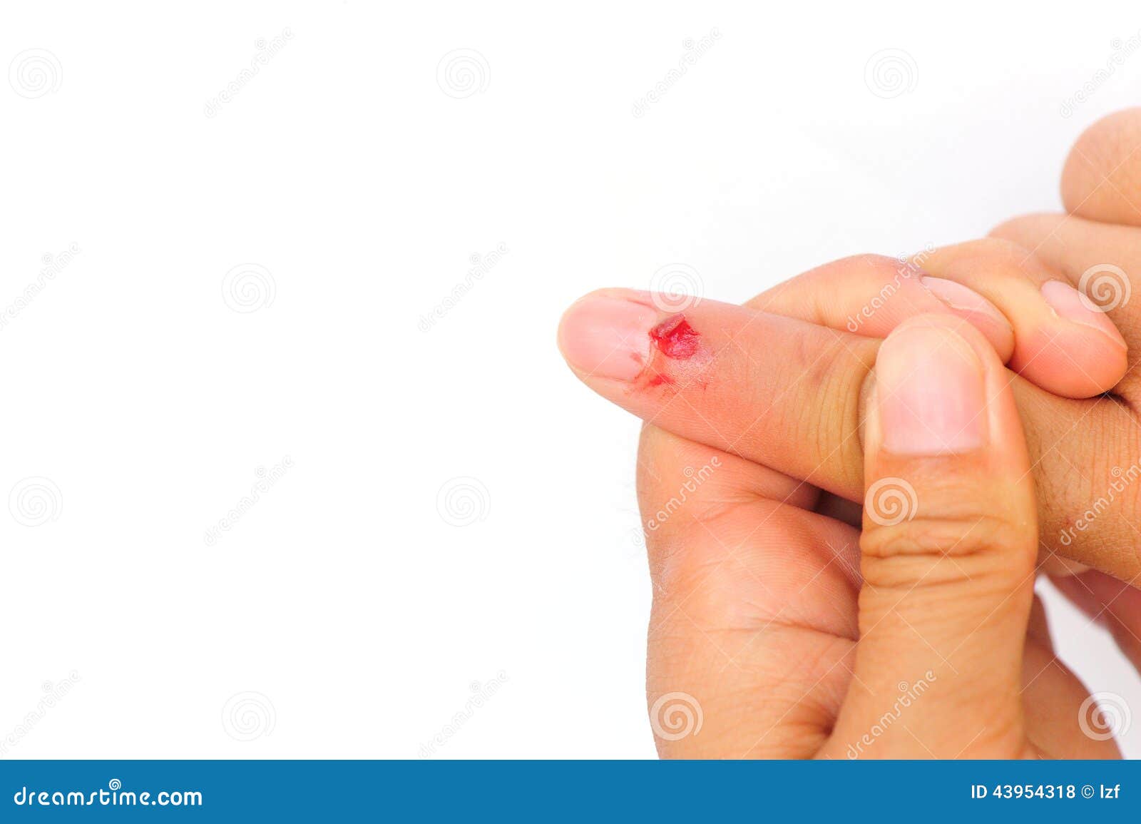 Injured Fingers Against White Stock Photo - Image of injured, female ...