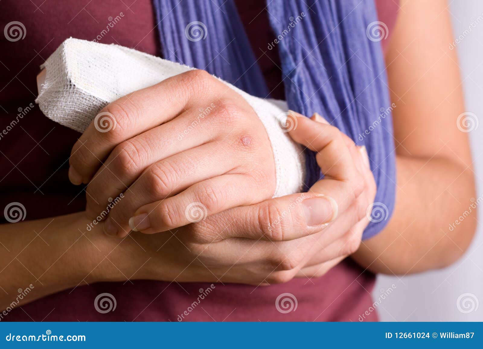 Injured hand stock photo. Image of broken, treat, sick - 12661024