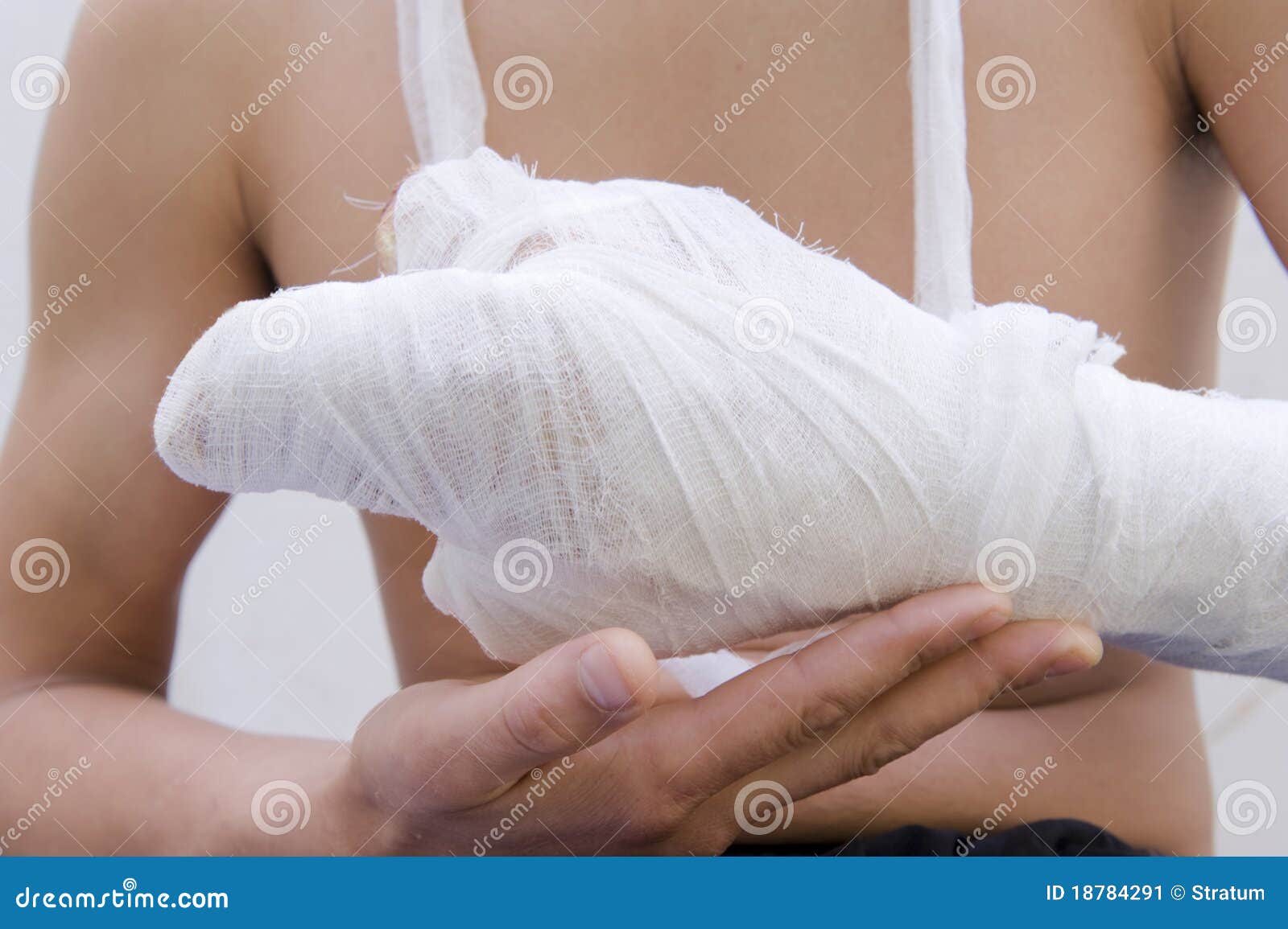 Injured hand stock image. Image of male, sling, hand - 18784291