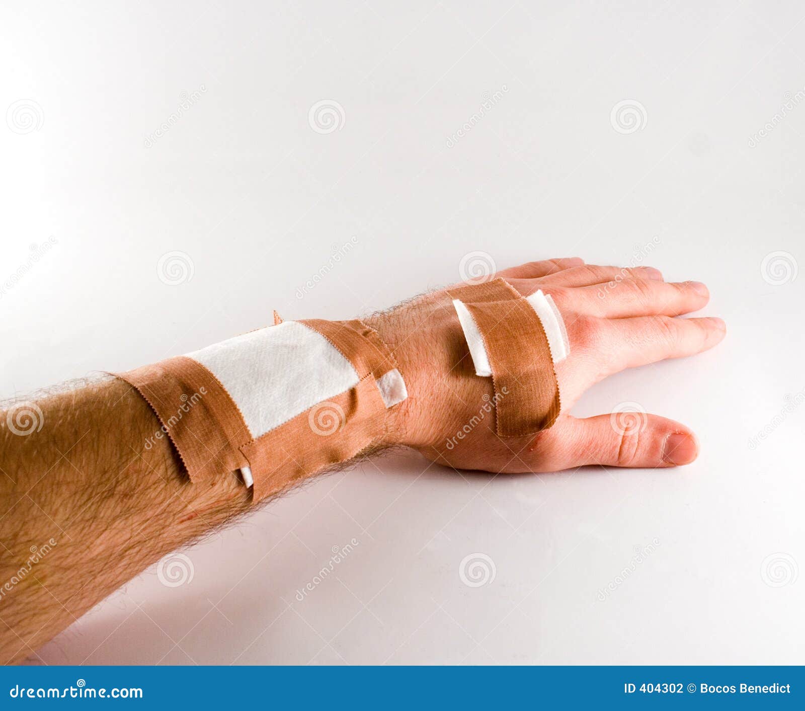 Injured hand stock photo. Image of first, skin, hand, accident - 404302