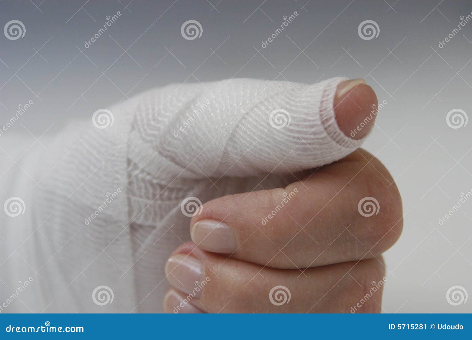 Injured hand stock image. Image of thumb, patient, pain - 5715281