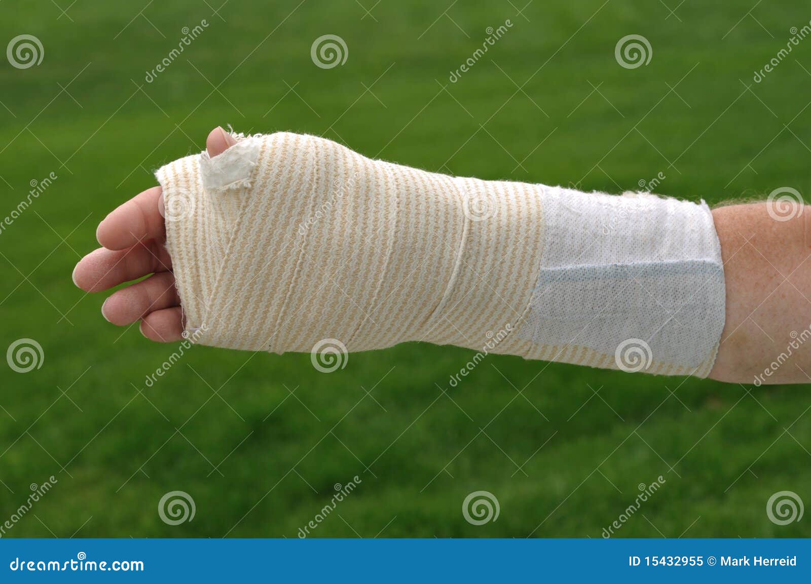 Injured Hand Filling A Insurance Claim Form Stock Photography ...