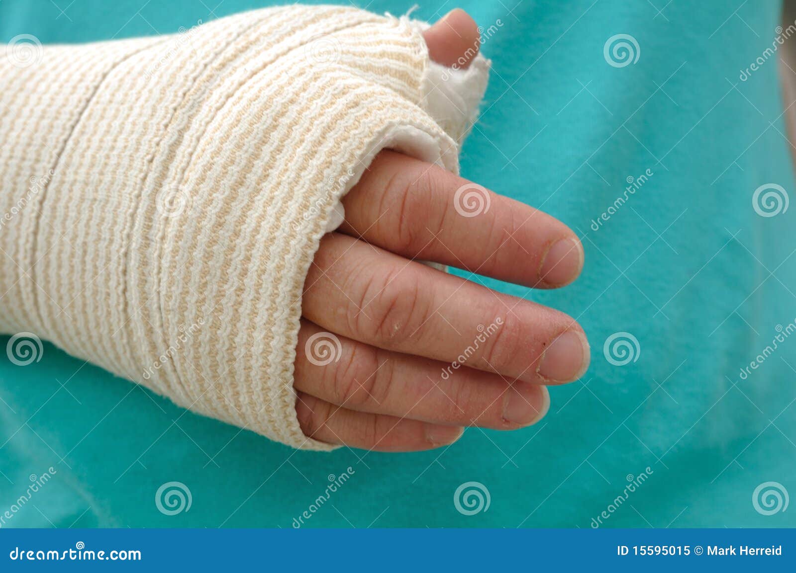 Injured Hand and Arm stock image. Image of care, healthcare - 15595015