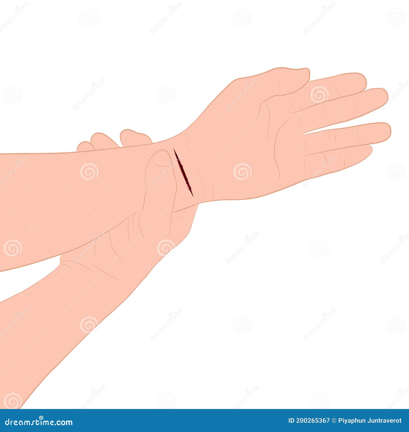 Injured Hand with Bleeding Gash with Wound on the Hand Palm Stock ...