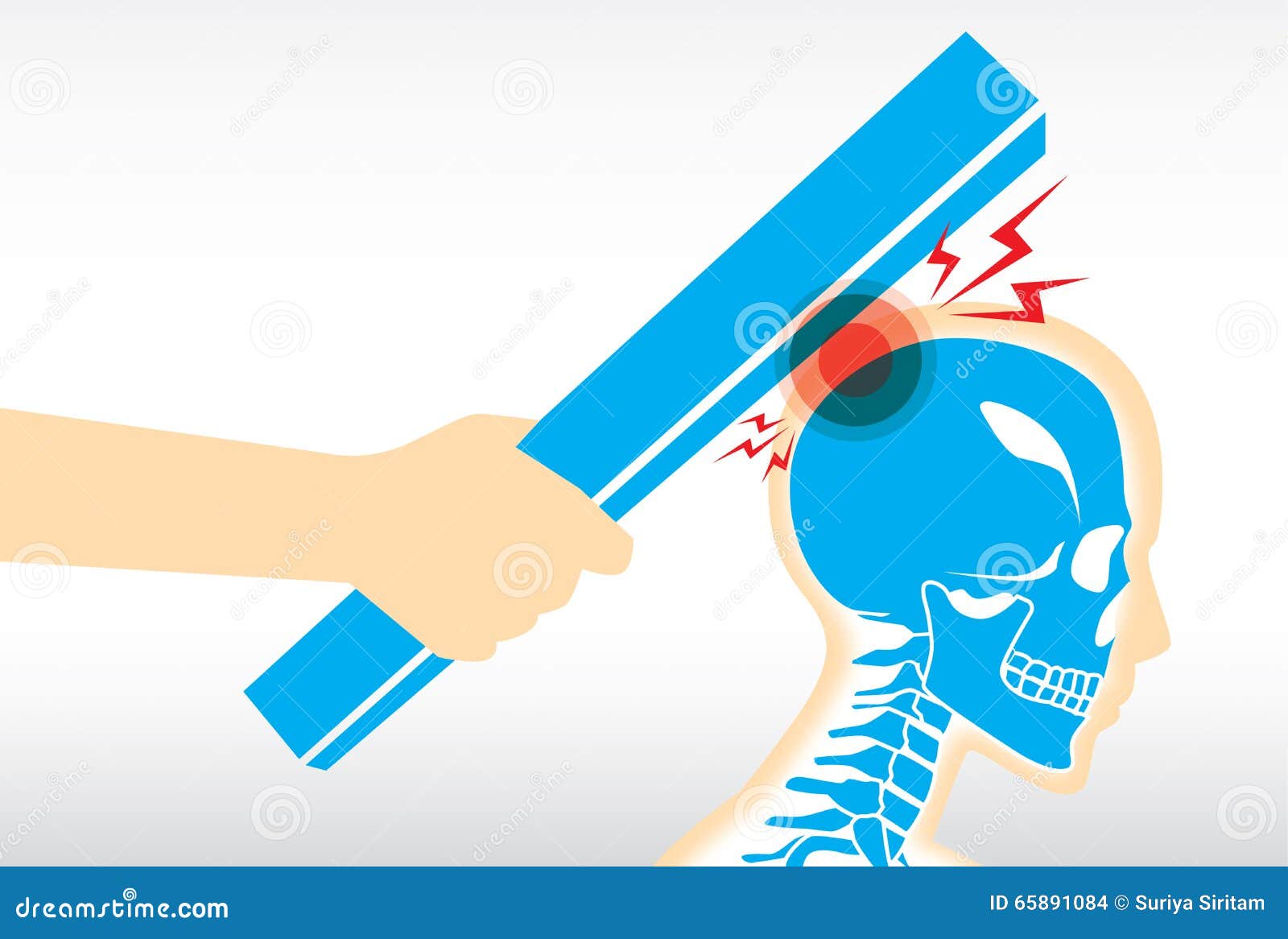 Injured at head from hit stock vector. Illustration of broken - 65891084
