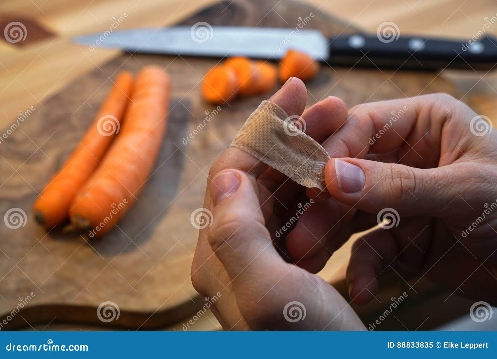 Injured in the Kitchen while Cooking Stock Image - Image of accident ...