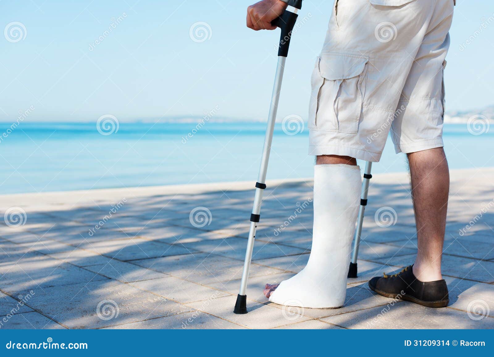 An Injured Man with a Plaster Stock Photo - Image of cast, healing ...