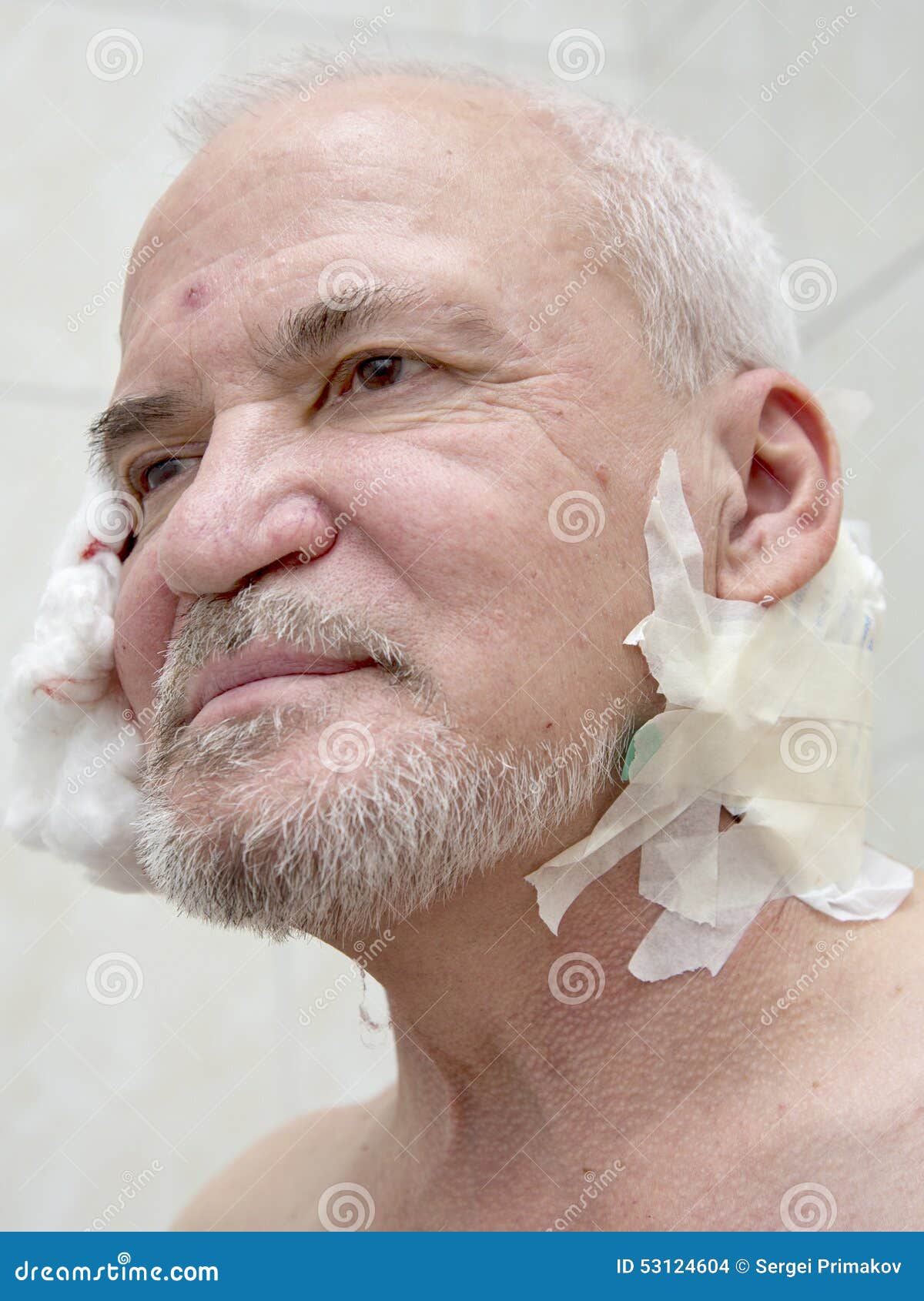 Injured old man stock photo. Image of contusion, accident - 53124604