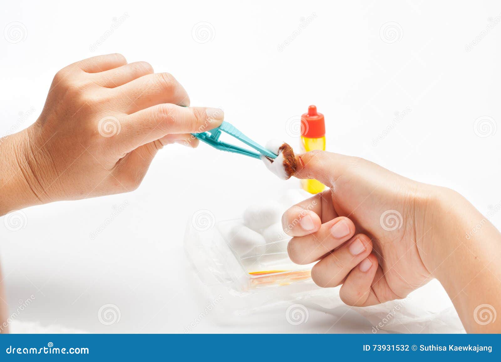 Injured Painful Finger with First Aid Stock Photo - Image of heal ...