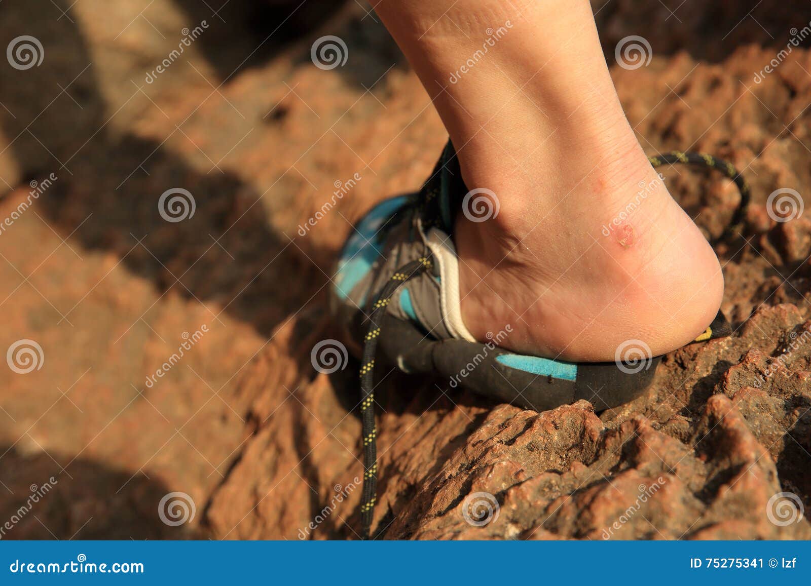 Injured rock climber heel stock image. Image of injury - 75275341
