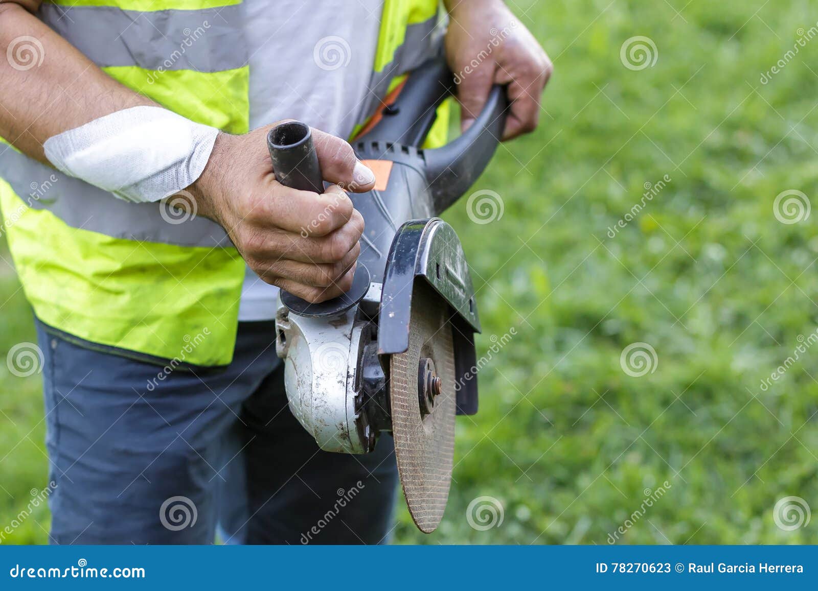 Injured Worker Hand with Grinder Machine Stock Image - Image of injured ...