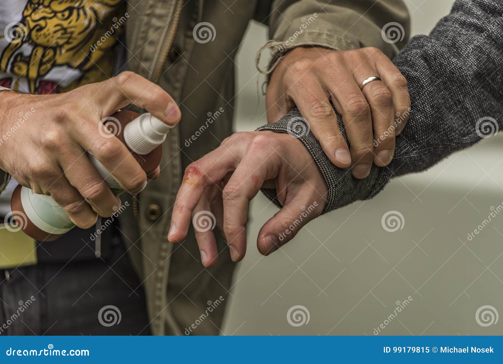 188 Wound Spray Stock Photos - Free & Royalty-Free Stock Photos from ...