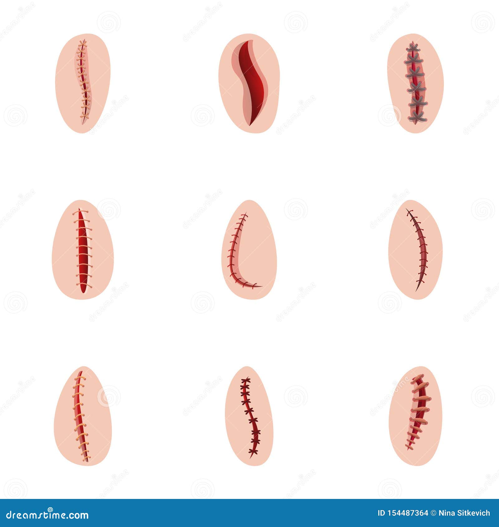 Injury Suture Icon Set, Cartoon Style Stock Vector - Illustration of ... Injury Suture Icon Set, Cartoon Style Stock Vector - Illustration of ...