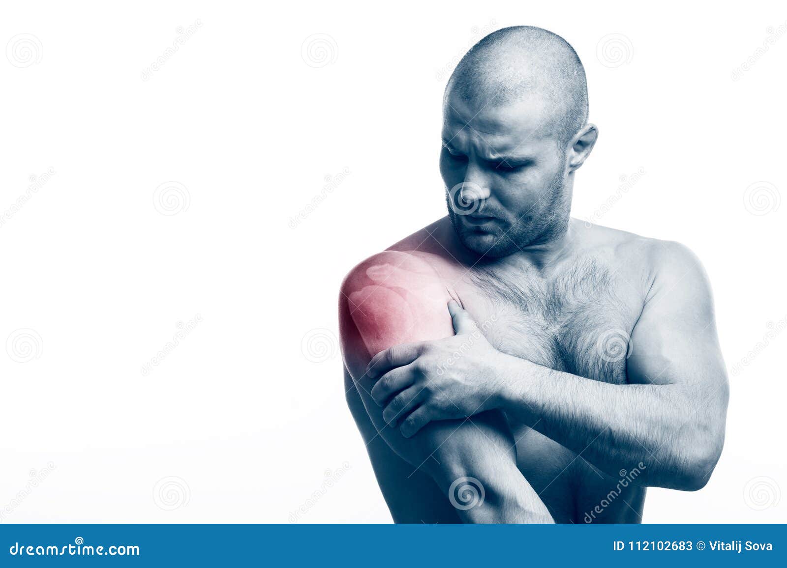 A Young Balding Bald Man Yells And Screams Holding His Head. The ... A Young Balding Bald Man Yells And Screams Holding His Head. The ...