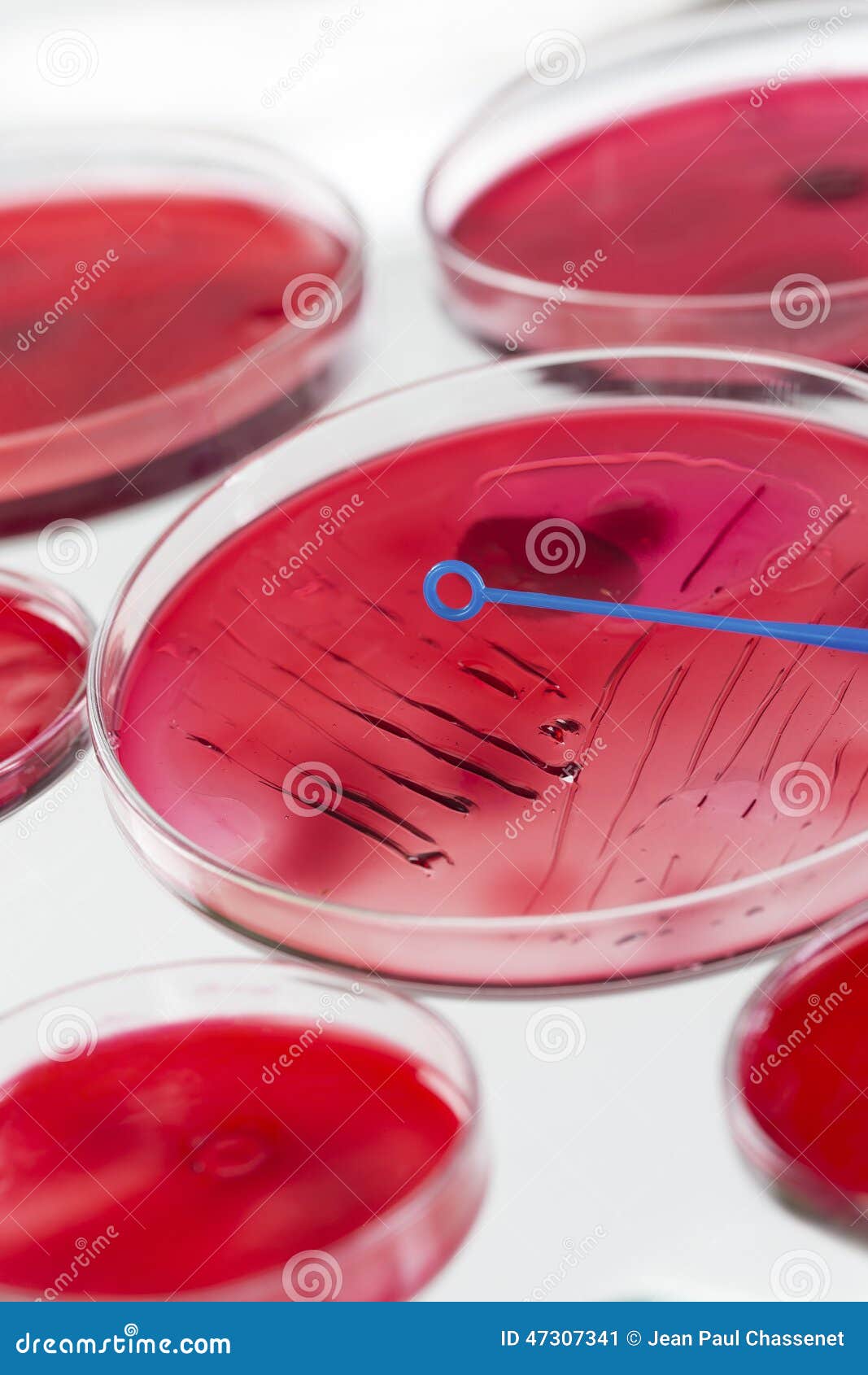 INOCULATION MICROBIOLOGY stock image. Image of equipment - 47307341