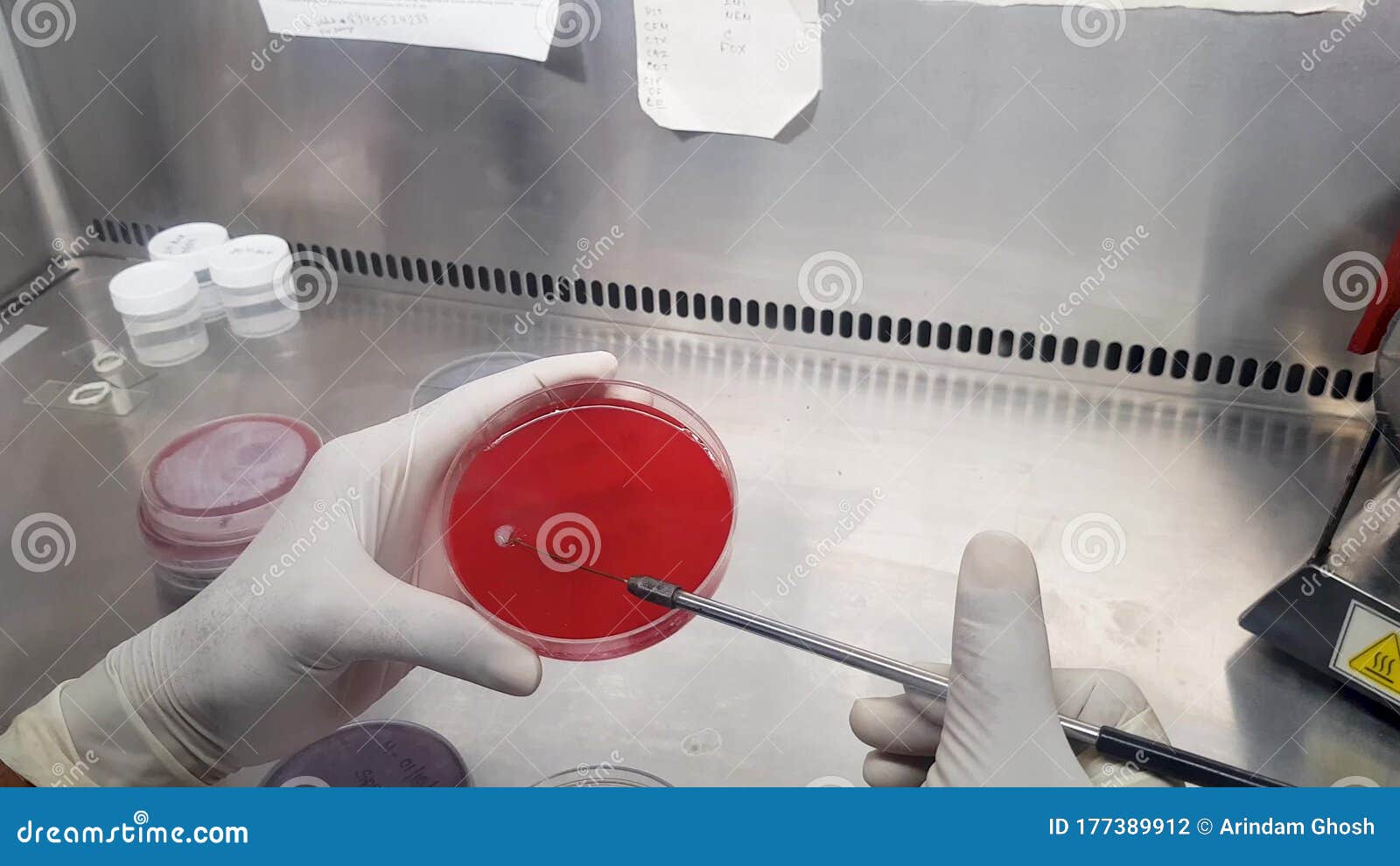 Inoculation of Pus Sample in a Blood Agar Culture Plate by an ...