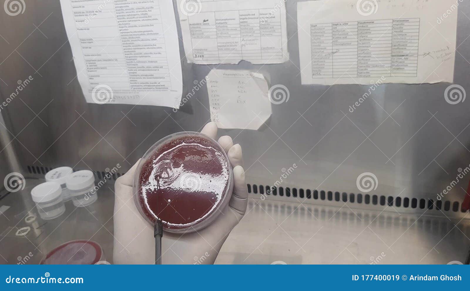 Inoculation of Sample in a Chocolate Agar Culture Plate by an ...