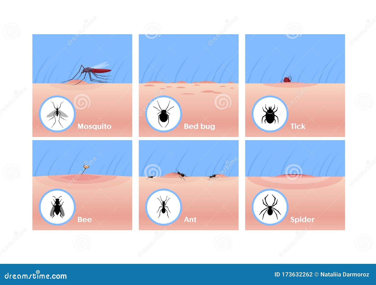 Insect Bites Flat Vector Illustrations Set. Mosquito Drinking Blood ...