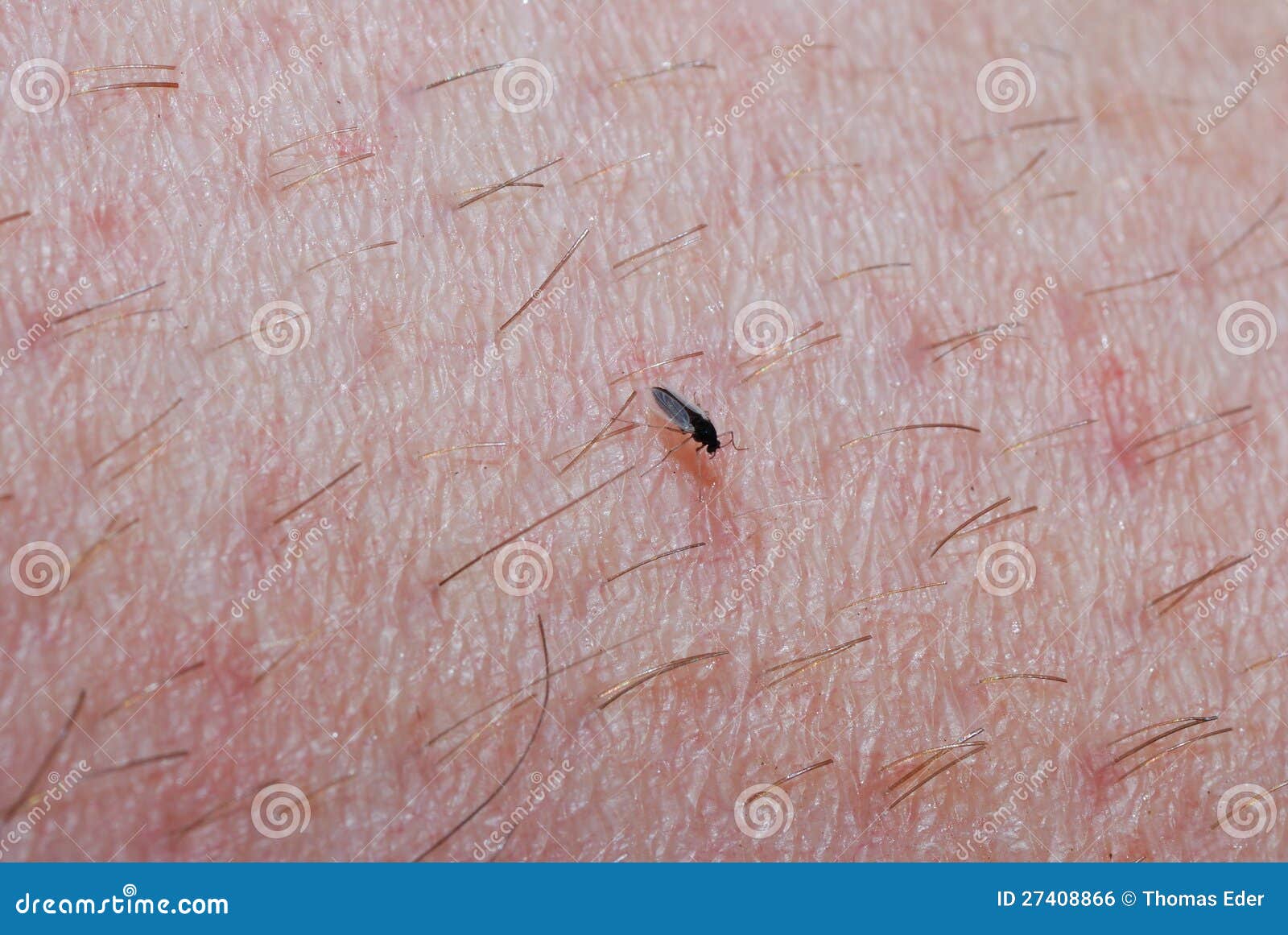 Insect on skin stock photo. Image of nature, garden, insect - 27408866