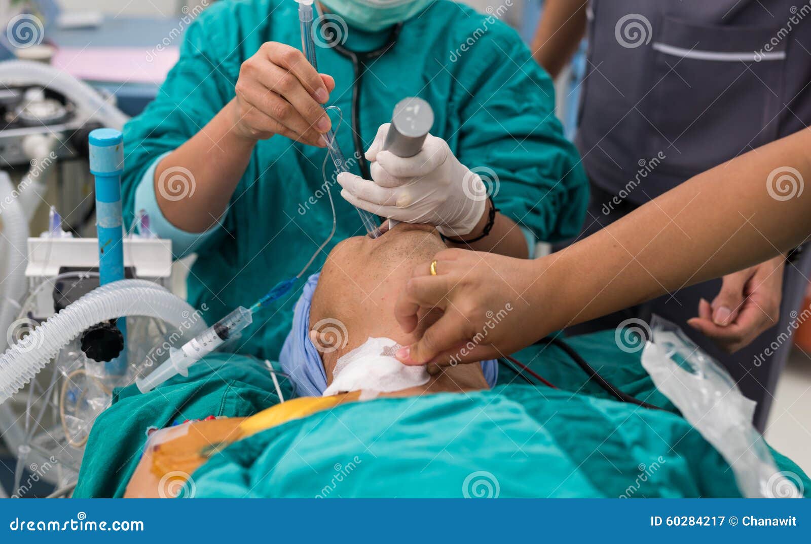 Insert endotracheal tube stock image. Image of hand, face - 60284217