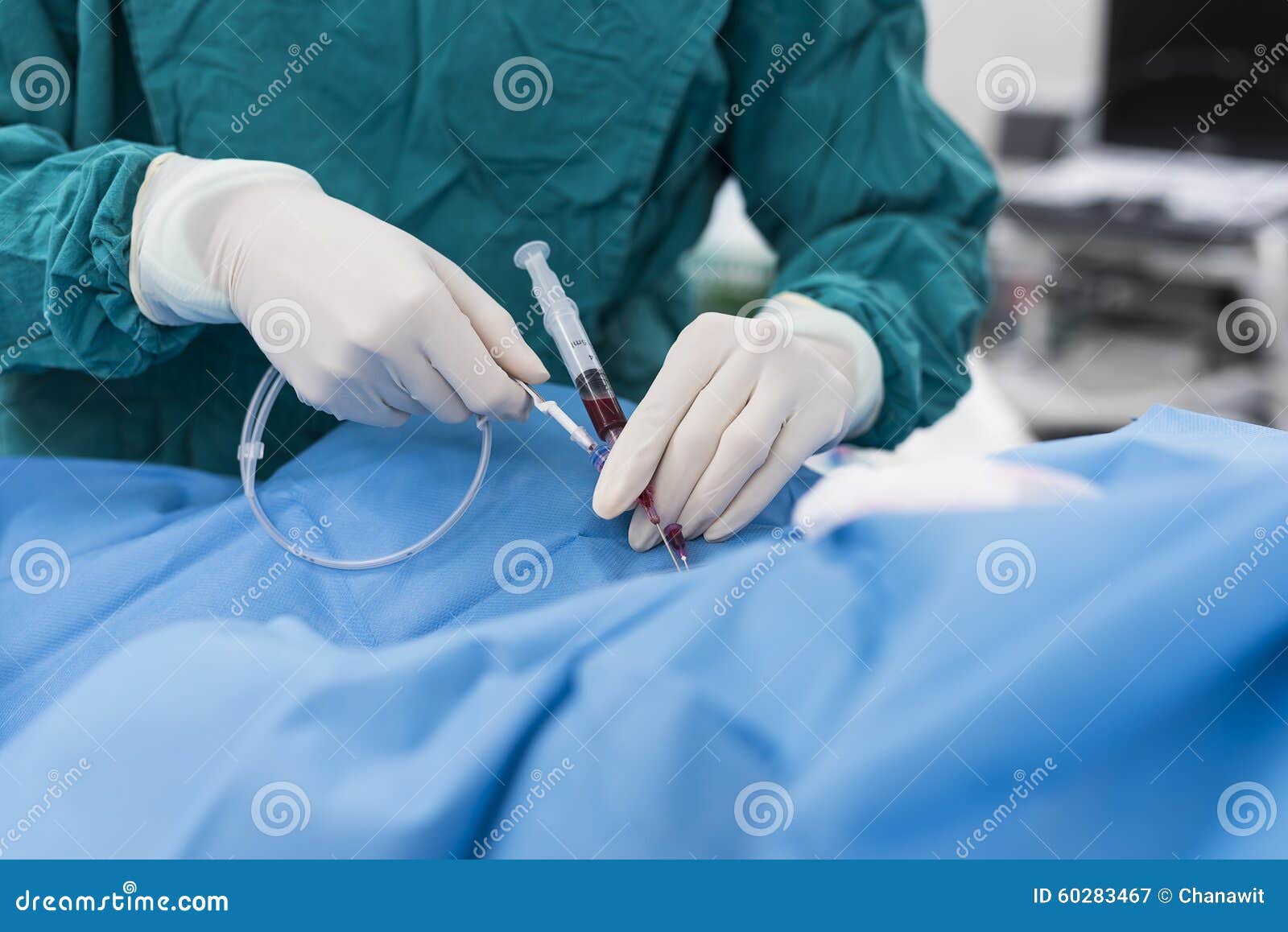 Insert guide wire stock image. Image of heart, anesthesiologist - 60283467