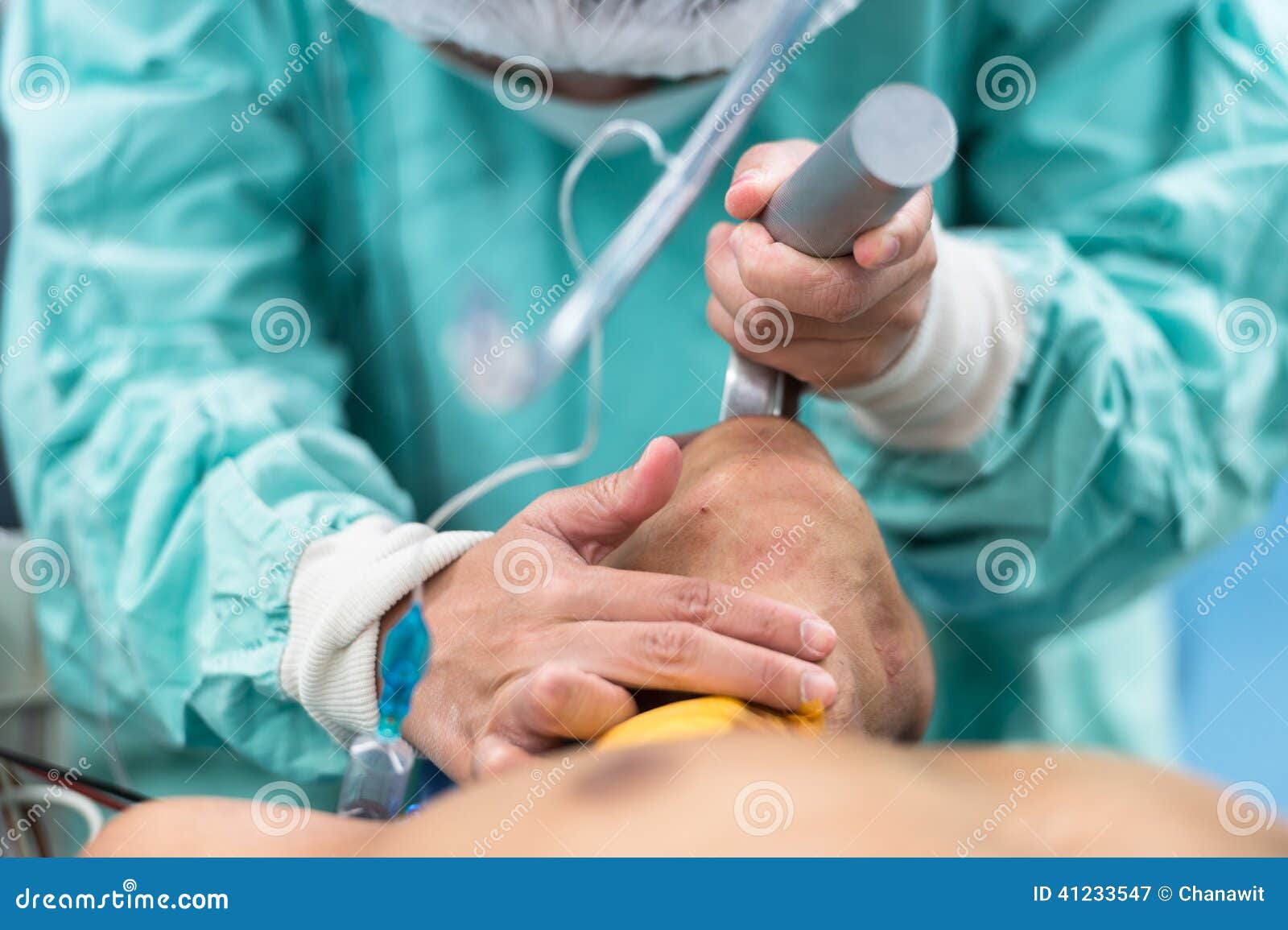 Insertion Endotracheal Tube Stock Image - Image of endoscope ...