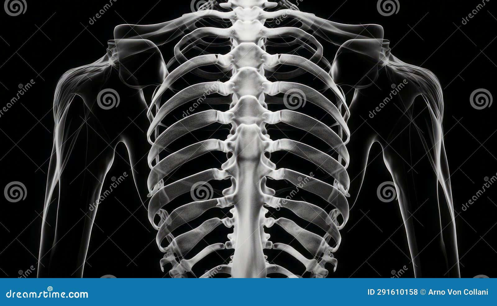 Inside the Human Frame: Detailed X-Ray View of the Spinal Column Stock ...