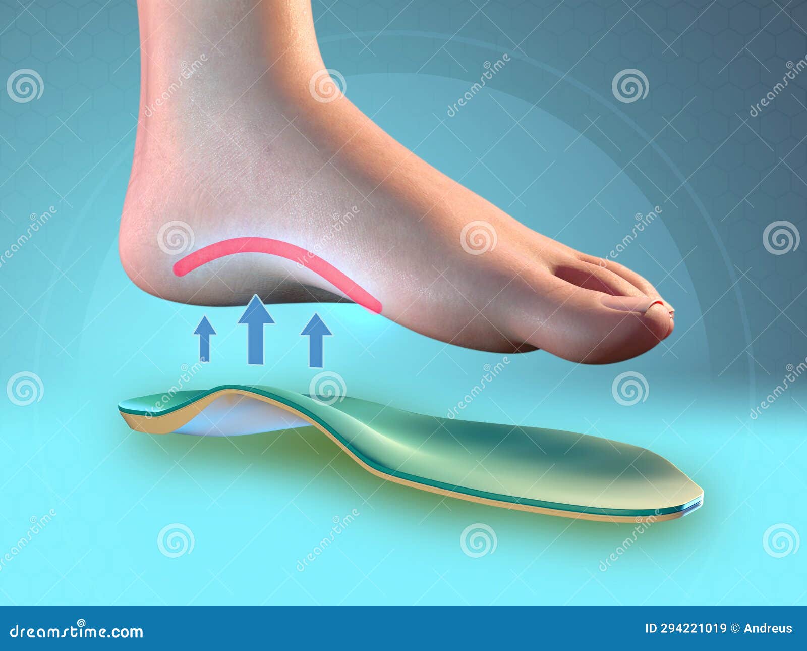 Arch Of Foot Pain Bones Skeleton Realistic Anatomy Illustration Cartoon ...