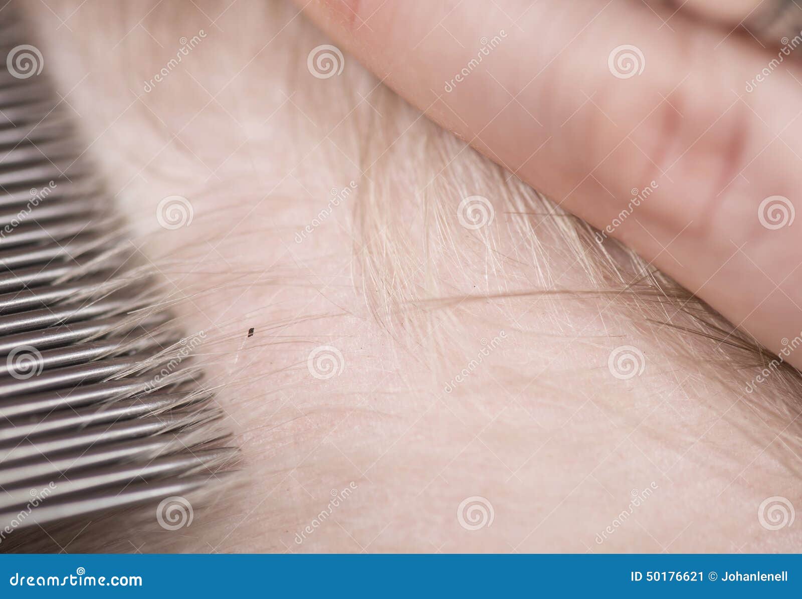 Inspecting Childs Head for Lice Stock Image - Image of caucasian ...