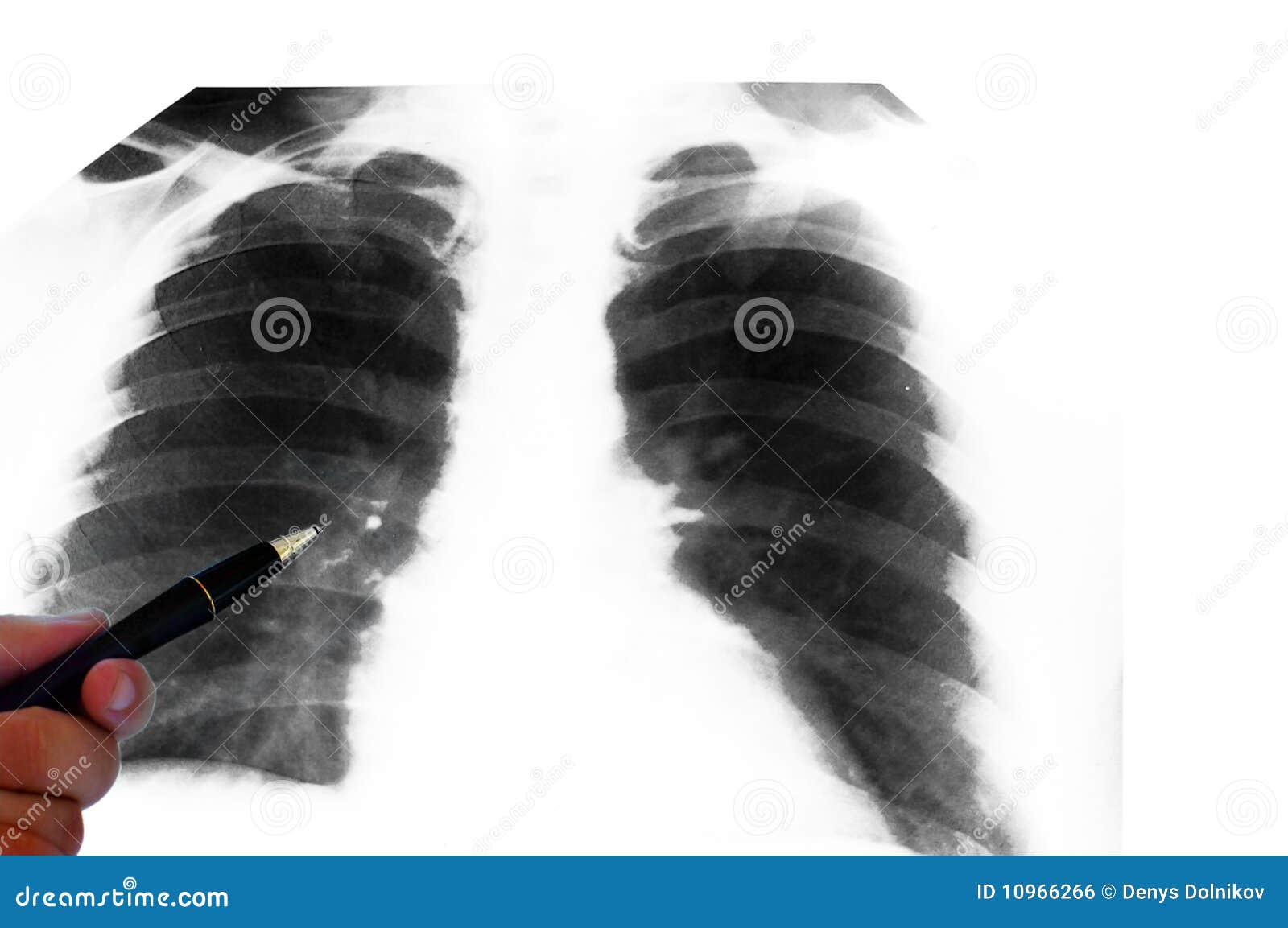 Inspecting rontgen stock photo. Image of profession, coat - 10966266