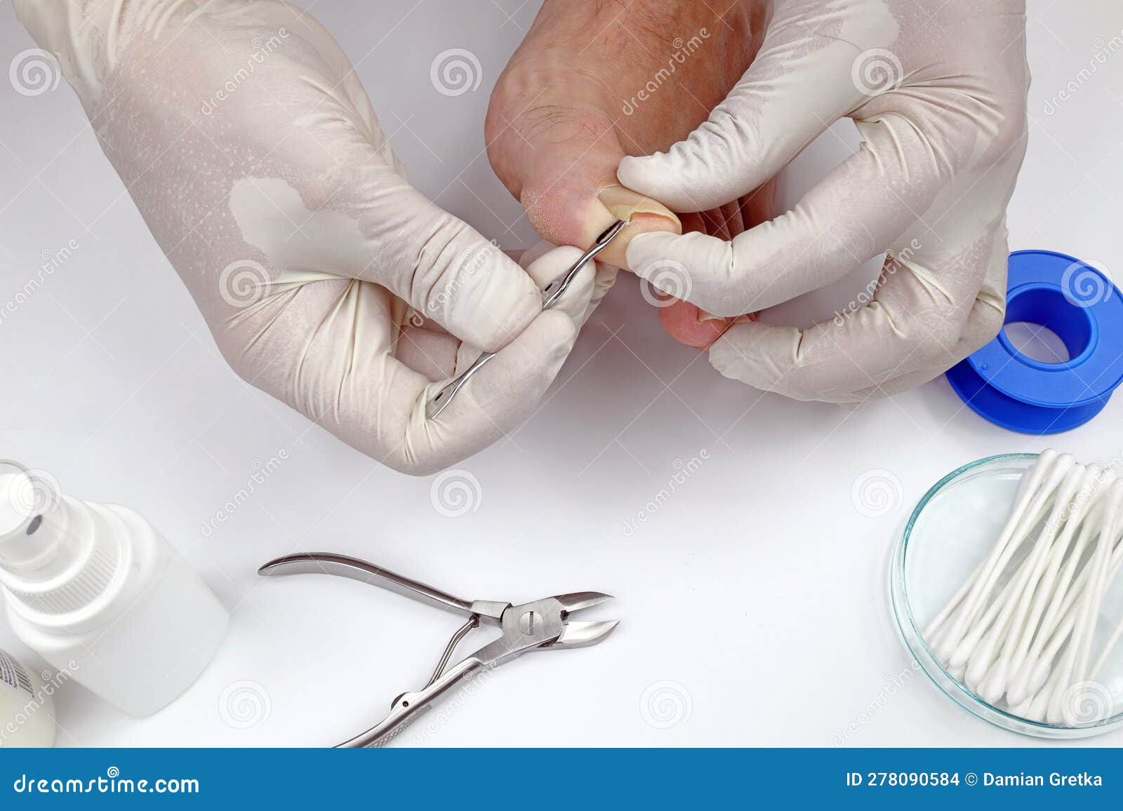 Inspection of the Nails in the Foot by the Doctor Stock Photo - Image ...