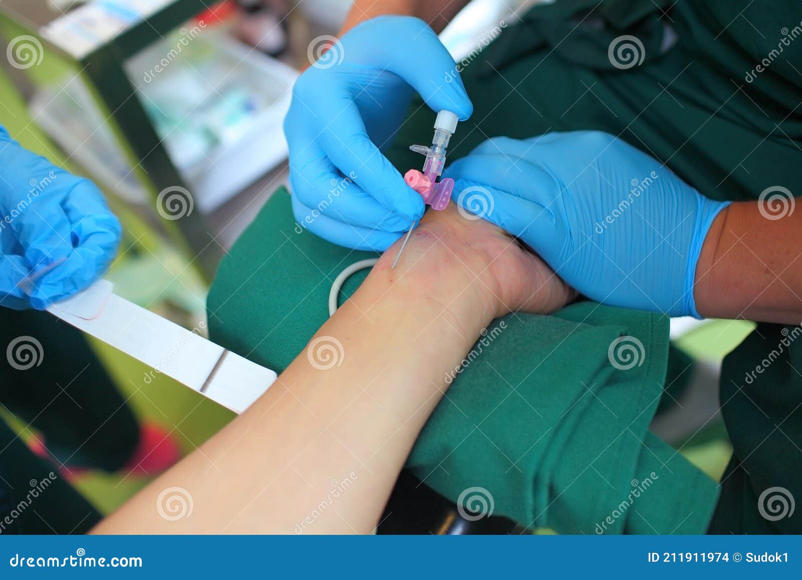 Installation of a Catheter into the Radial Artery. Preparing for ...