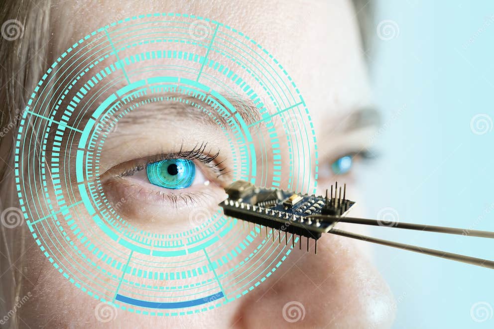 Installing Electronic Chip into Human Bionic, Neuroprosthetic Eye ...
