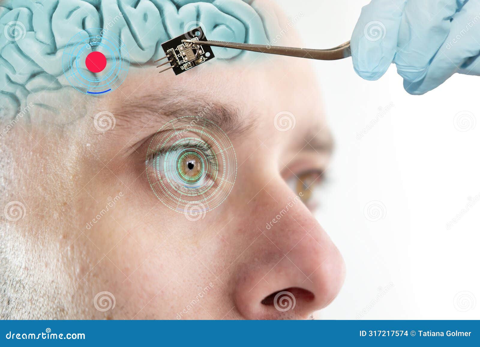 Installing Electronic Chip into Human Brain, Applied in Various Fields ...