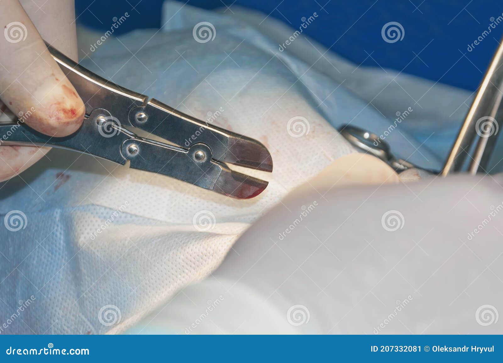 Instruments Used by the Surgeon during the Operation Stock Image ...
