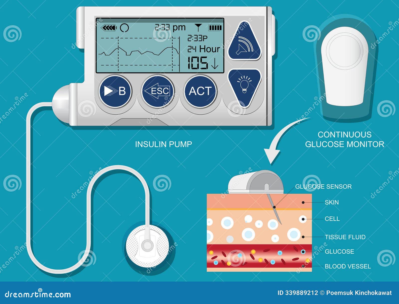 Insulin Release From Pancreas Organ Stock Photography | CartoonDealer ...