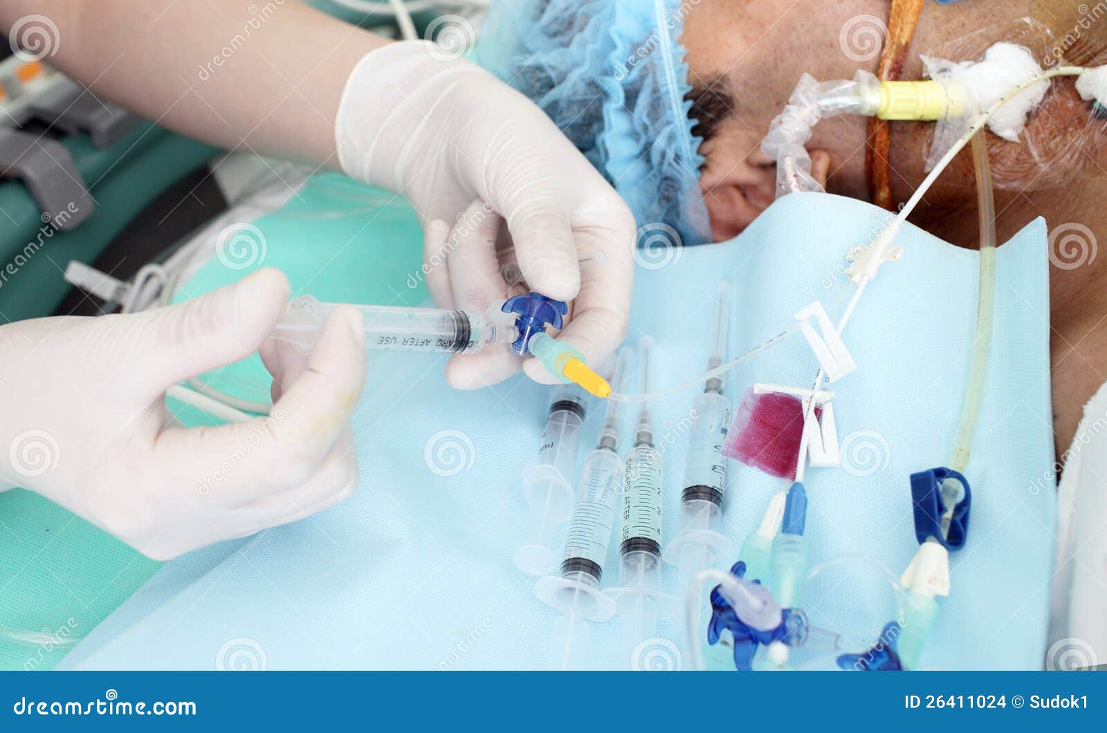 Intensive Cure of Patient in ICU Stock Photo - Image of infusion ...