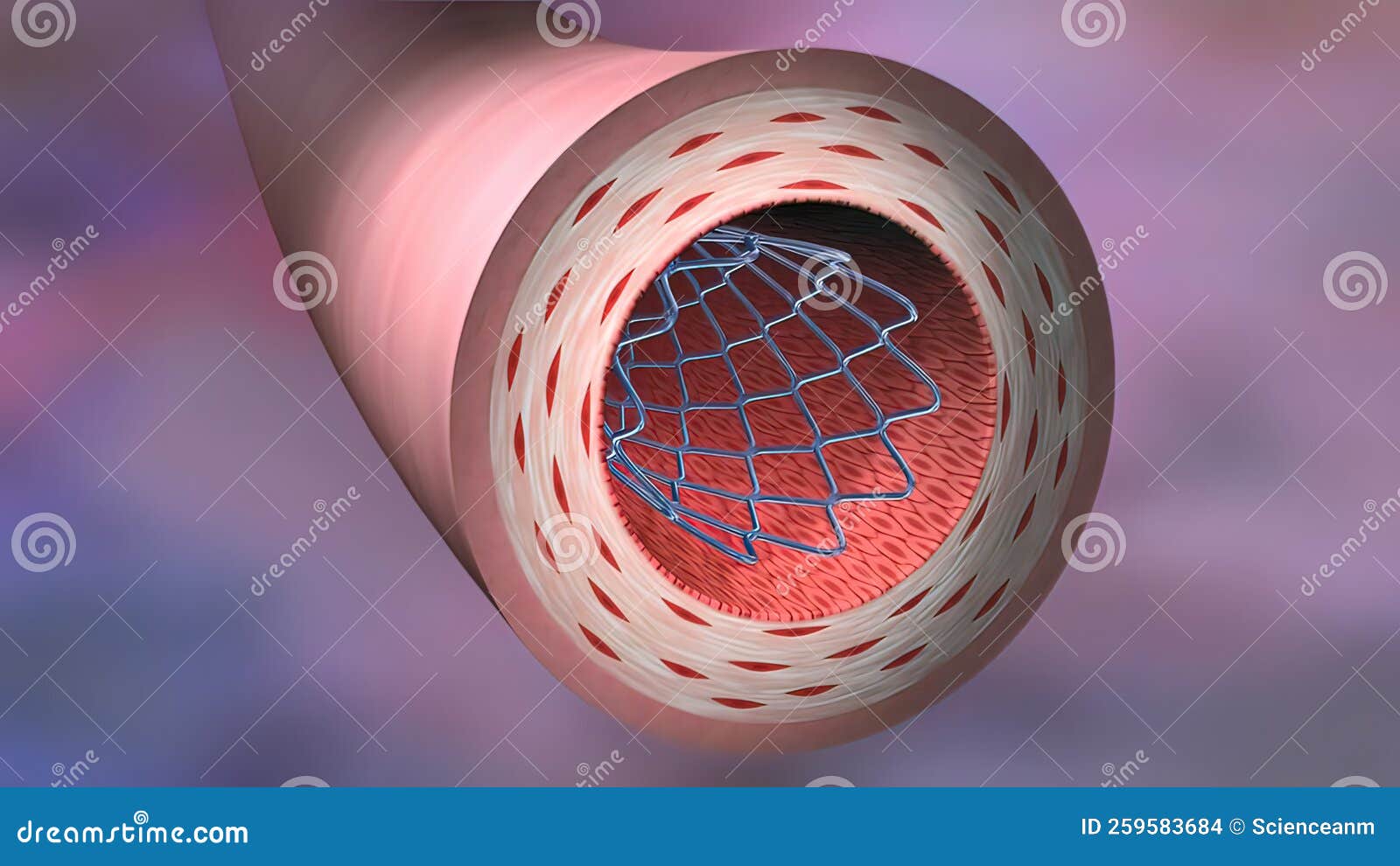 Interactions of Synthetic Polymers with Cell Membranes and Model ...
